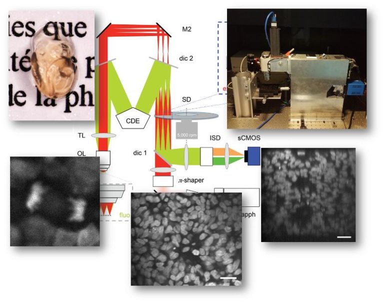 Fast volumetric Imaging of Brain Organoids With a New Single-Objective ...